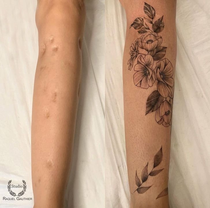 15 People who turned their scars into something beautiful through ...
